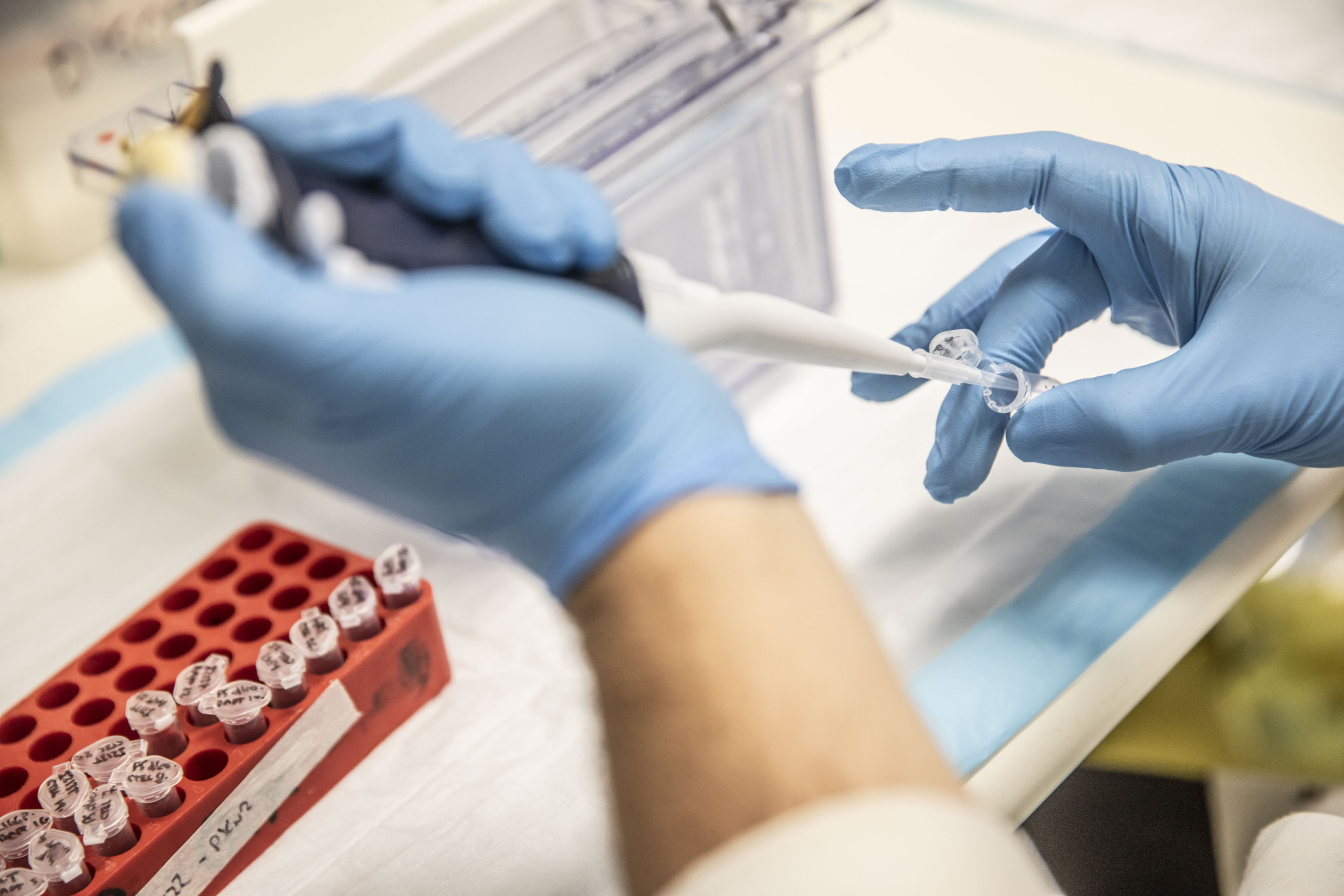 Advancing treatment options and early diagnosis in multiple sclerosis ...